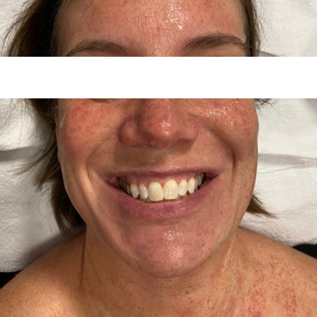 Case #5545 - Mountcastle Medical Spa and Laser Center