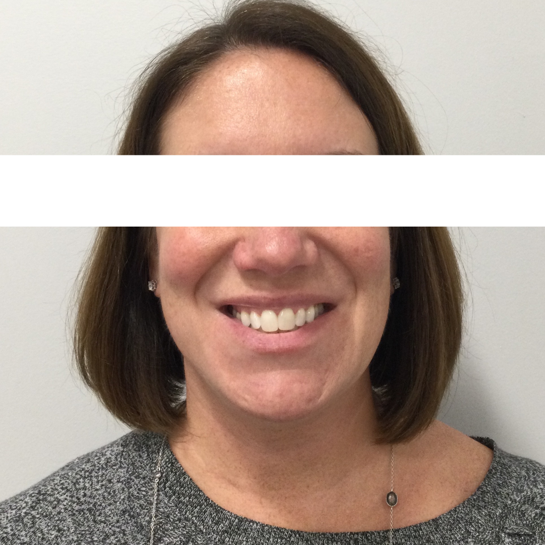 Case #5545 - Mountcastle Medical Spa and Laser Center