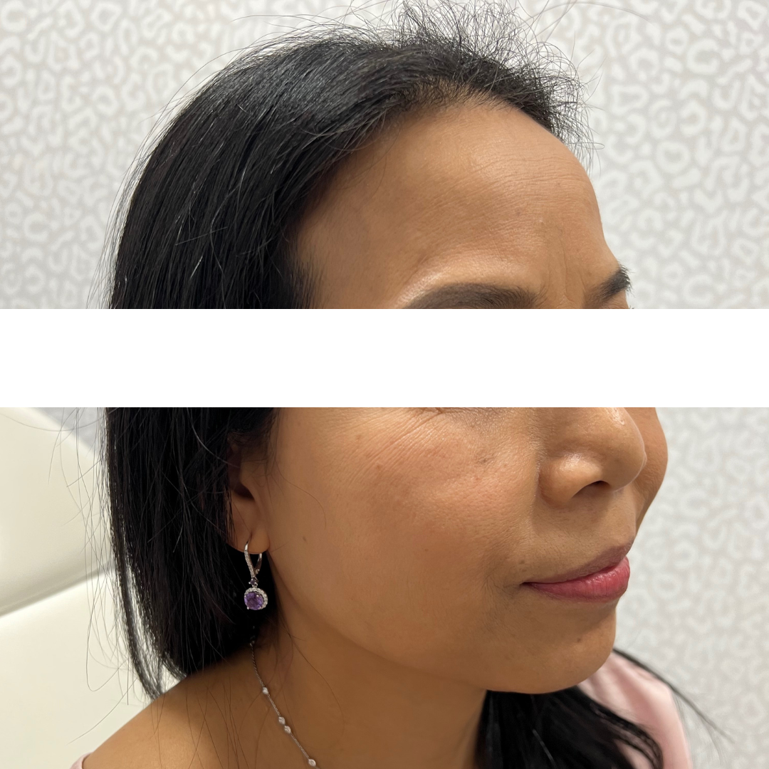 Case #3493 – Mountcastle Medical Spa and Laser Center