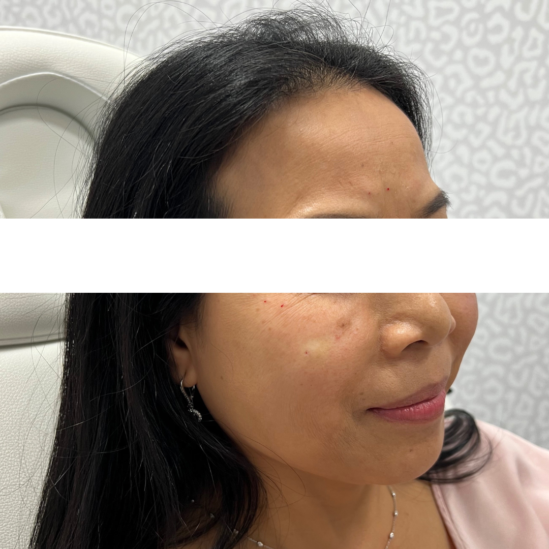 Case #3493 - Mountcastle Medical Spa and Laser Center